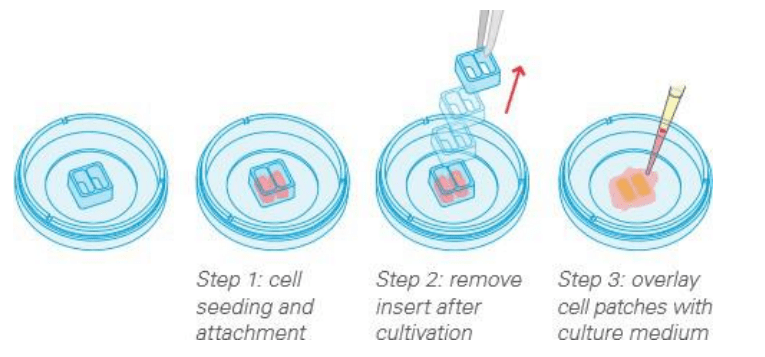 ibidi Culture-Insert划痕实验——细胞迁移 - 知乎
