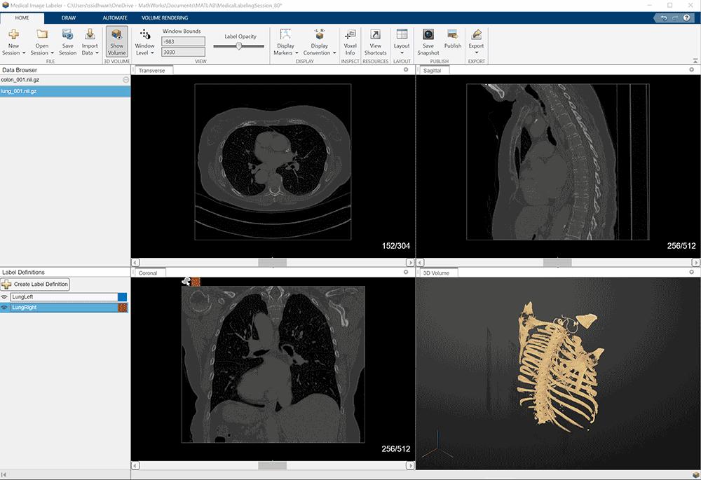 MATLAB和Simulink R2022b提供全新的Simscape Battery以及更新，简化并自动化基于模型的设计 - 知乎