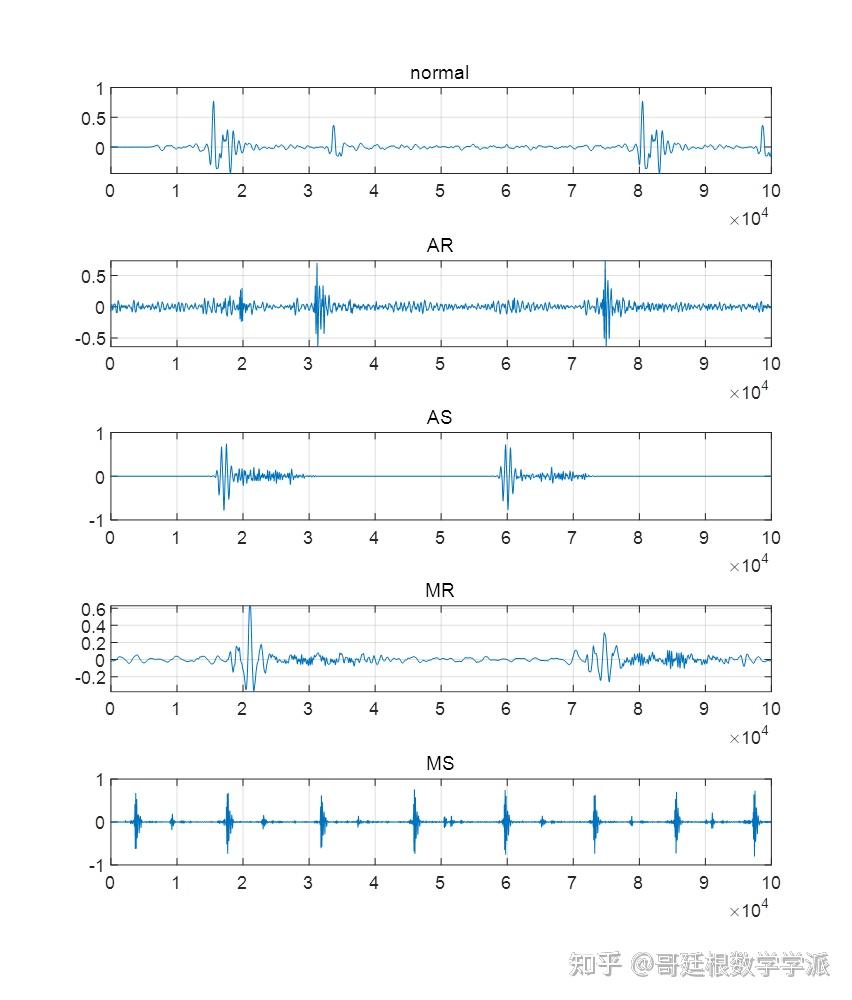 基于连续小波变换和GoogLeNet的PCG心音信号分类算法 - 知乎