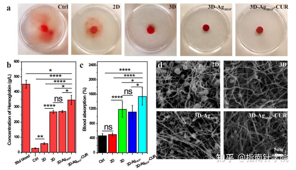 Chemical Engineering Journal: 具有原位生长的银金属有机框架的三维层状纳米纤维海绵用于促进伤口愈合 - 知乎