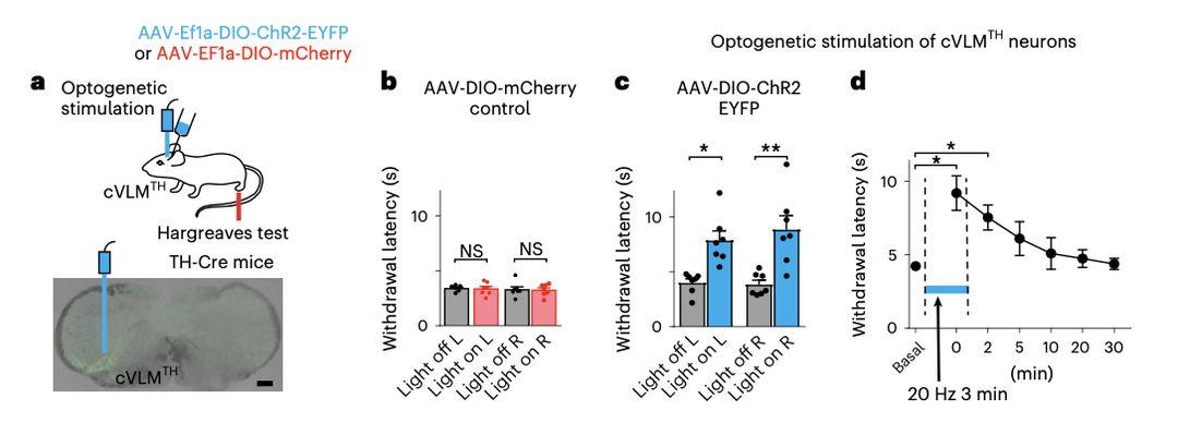 Nature Neurosci：疼痛调控新神经环路 - 知乎