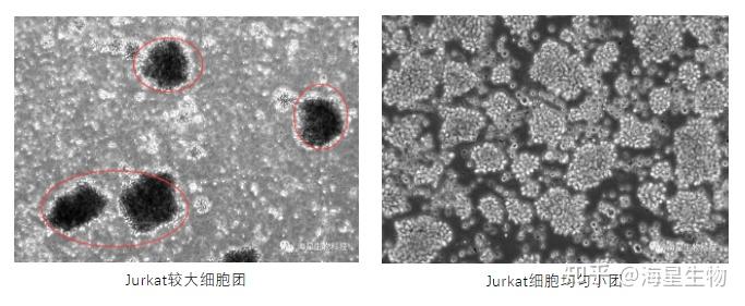 人T淋巴细胞白血病细胞(Jurkat)培养要点 - 知乎
