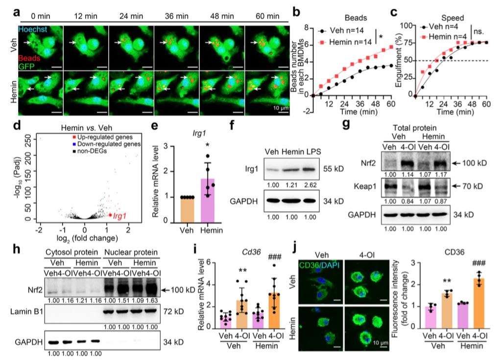 eBioMedicine丨Irg1/衣康酸轴的靶向巨噬细胞吞噬功能可改善脑出血性中风和腹膜炎的预后 - 知乎