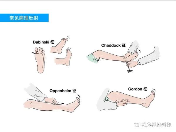 神经系统疾病诊断核心思路详解，按这3步走！ - 知乎