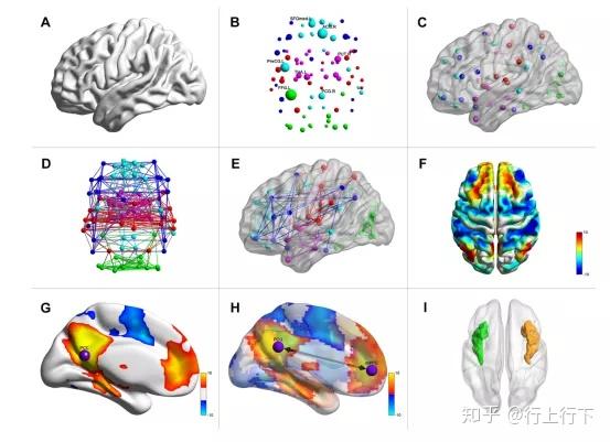 BrainNet Viewer:人类大脑连接的网络可视化工具 - 知乎