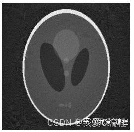 对滤波反投影重建算法的研究以phantom图进行matlab仿真，构建滤波器，重建图像 - 知乎