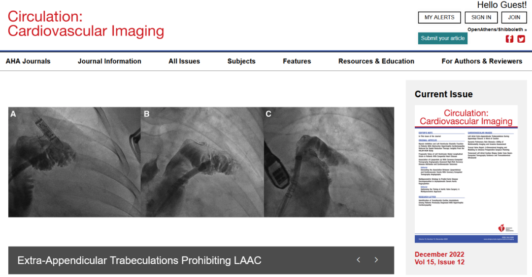 如何选择合适的SCI期刊？13个心血管领域期刊推荐