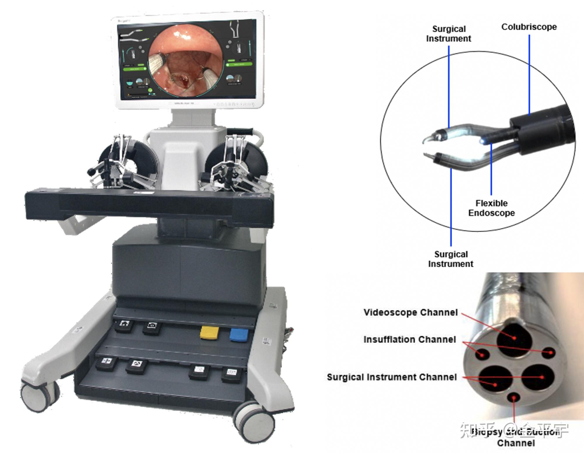 治疗性内窥镜机器人平台：机遇、挑战与未来发展 - 知乎