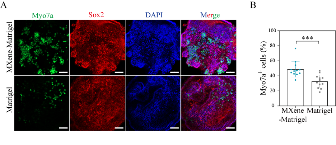 Adv Sci︱东南大学柴人杰团队在耳蜗类器官功能性毛细胞再生方面取得重要进展 - 知乎