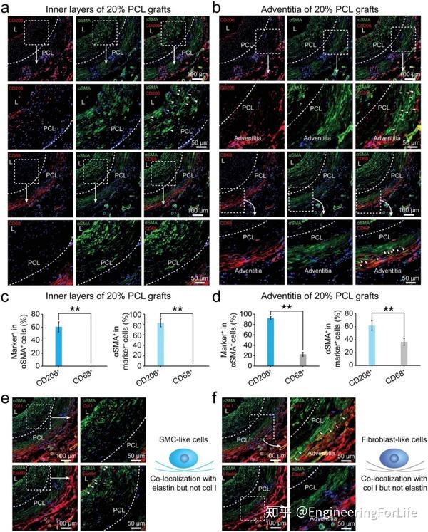 Small： PGS-PCL复合人工血管用于颈总动脉移植 - 知乎