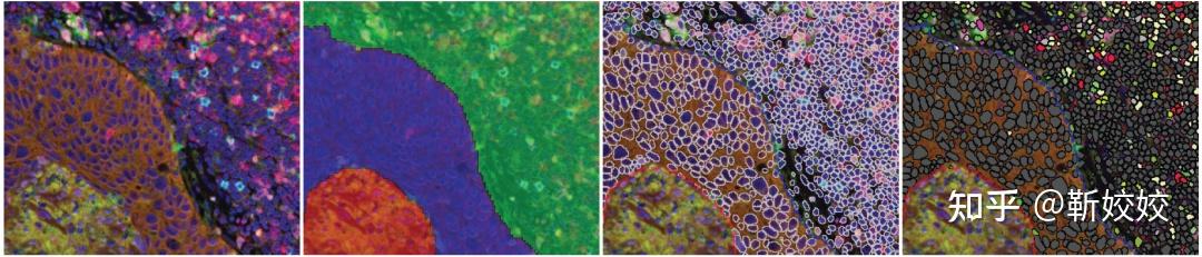 Visiopharm AI驱动多重免疫荧光表型分析：在空间环境中捕捉细胞多样性 - 知乎