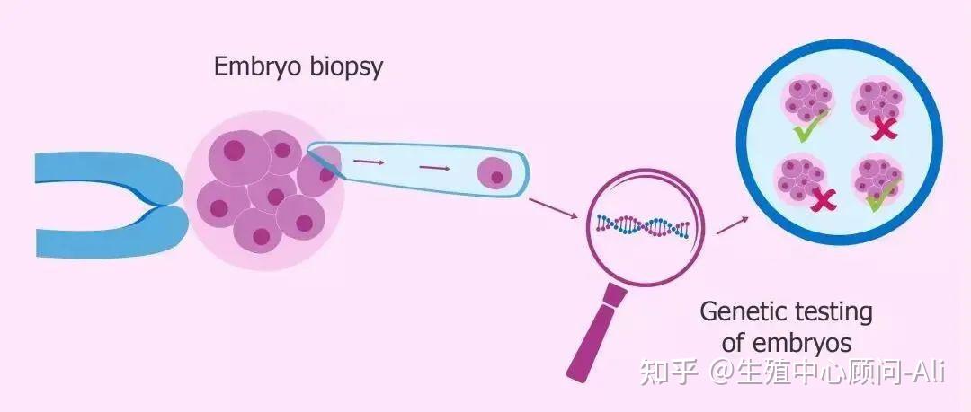 科普|第三代试管（PGT）技术胚胎遗传学筛选流程大揭秘~ - 知乎