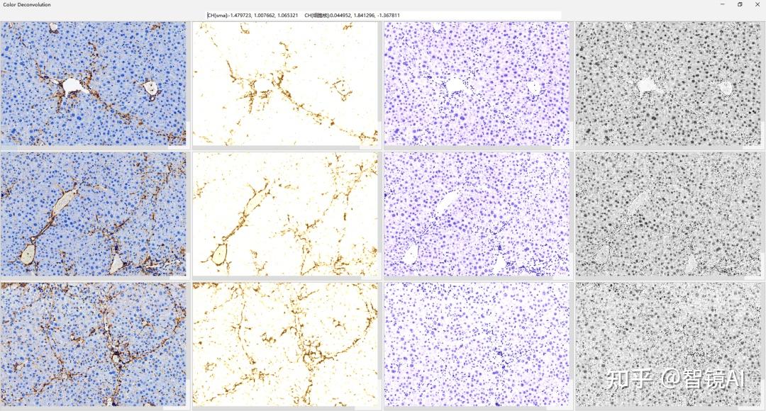 免疫组化分析前的必做功课：Color Deconvolution（颜色解卷） - 知乎