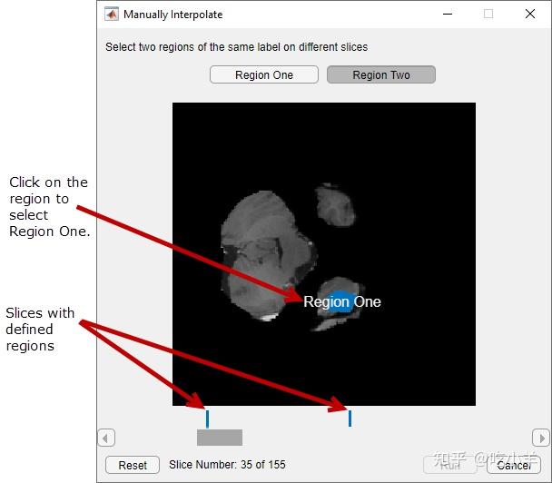 MATLAB图像处理：90：使用 Volume Segmenter 创建二进制蒙版 - 知乎