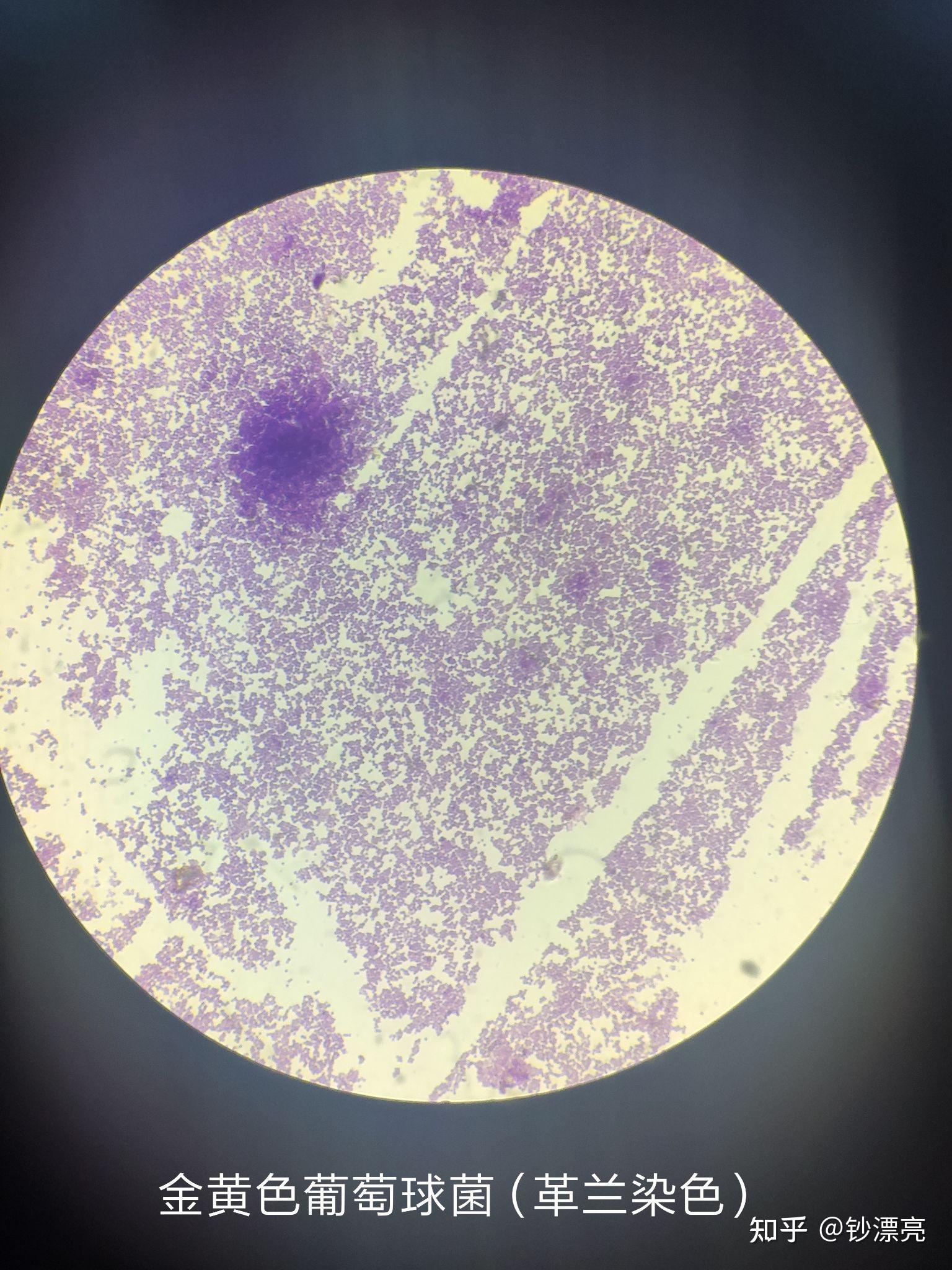 微生物显微镜🔬下观察 - 知乎
