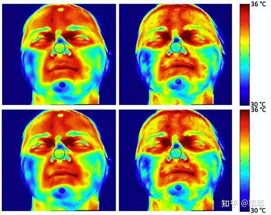 人脸识别新突破！面部温度解密健康状况！面容特征帮助预防冠心病 - 知乎