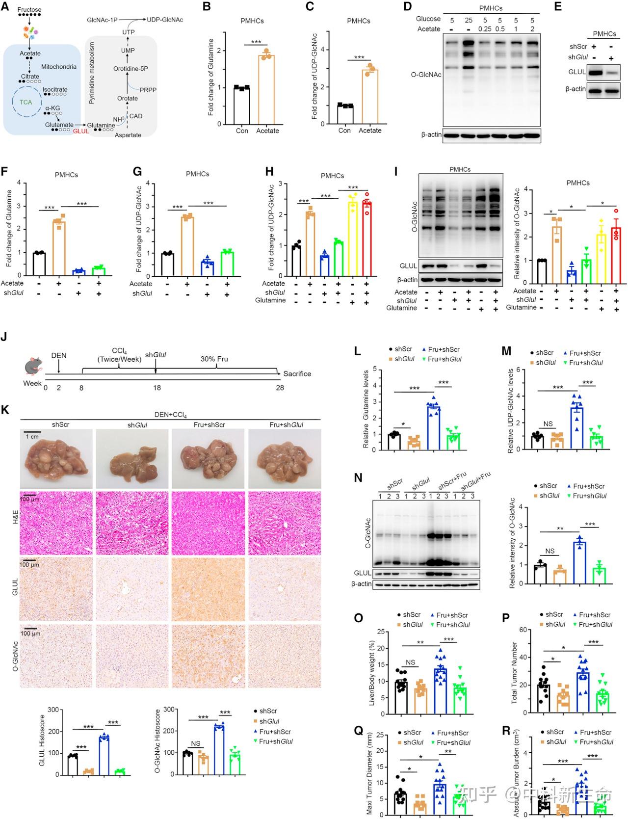 署名文章Cell Metabolism（IF 29）丨重庆医科大学利用代谢组和O-糖基化蛋白组揭示高果糖饮食促进肝癌进展的新机制 - 知乎
