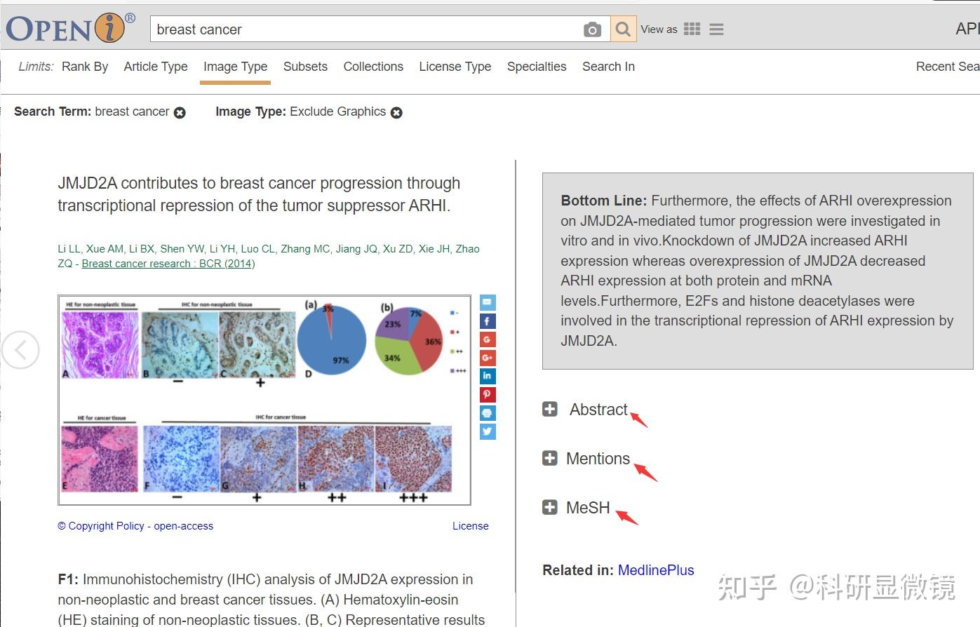 SCI写作-利用NCBI下的网页OPENI进行图片检索，制作高大上的流程图，反向检索文献 - 知乎