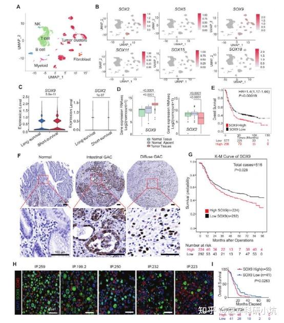 Gut：上皮SOX9通过促进免疫抑制肿瘤微环境驱动胃腺癌的进展和转移 - 知乎