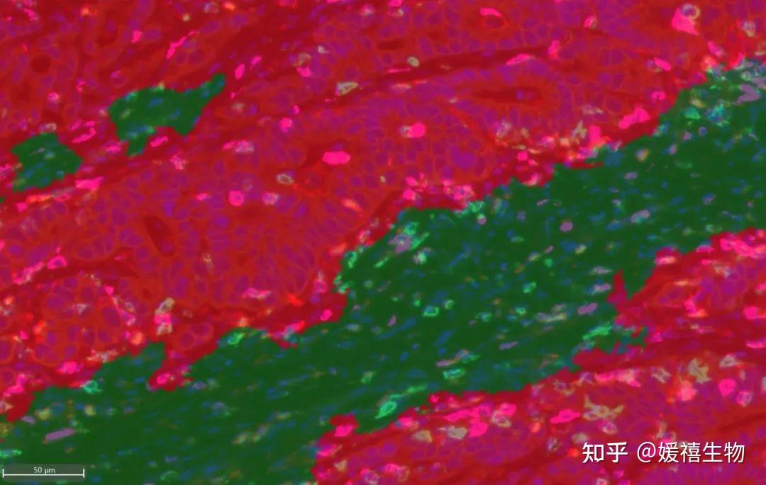 Treg-免疫抑制T细胞研究进展 - 知乎