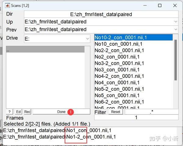10-SPM-fmri任务态 二阶分析： 配对样本t检验 - 知乎