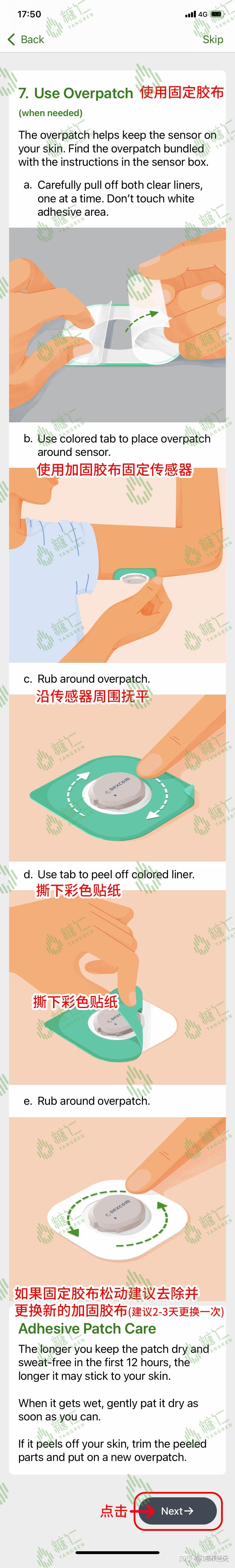 【德康G7】Dexcom G7安装配置教程 - 知乎
