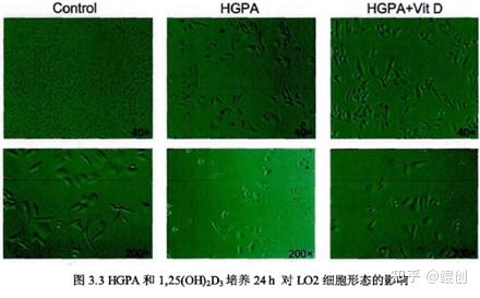 高糖高脂诱导的L02细胞（人源正常肝细胞）糖尿病肝损伤模型的建立方法 - 知乎