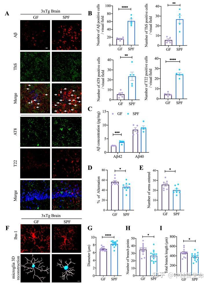 Gut（IF 23.059）| 肠菌-脑轴-免疫：肠道菌群调控阿尔茨海默病的新机制 - 知乎