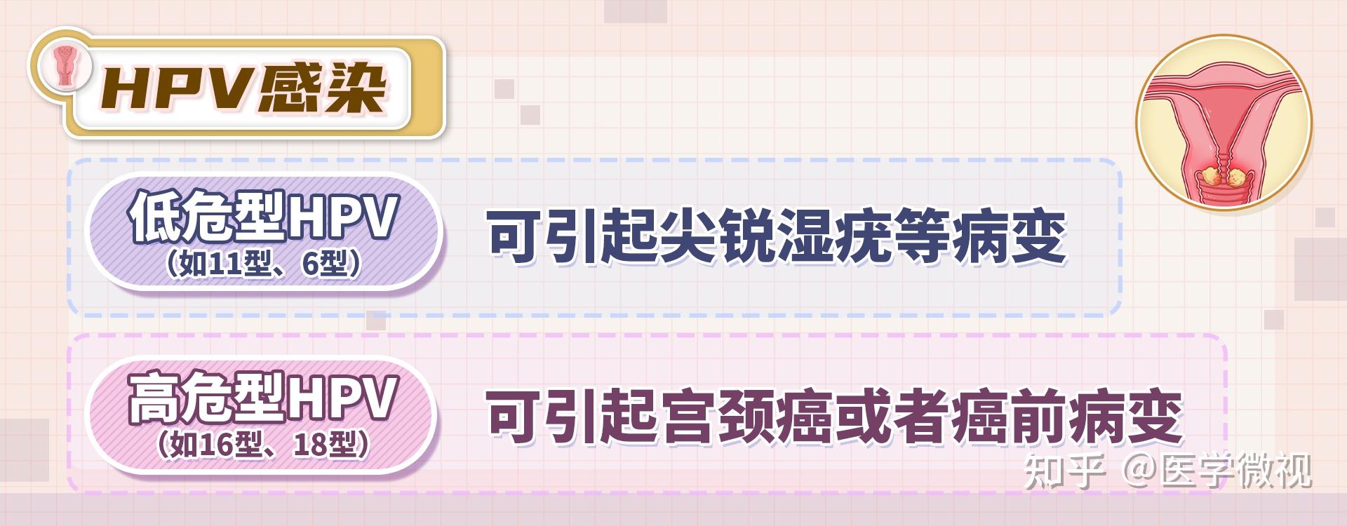 一篇文章，教你看懂宫颈TCT检查结果！ - 知乎