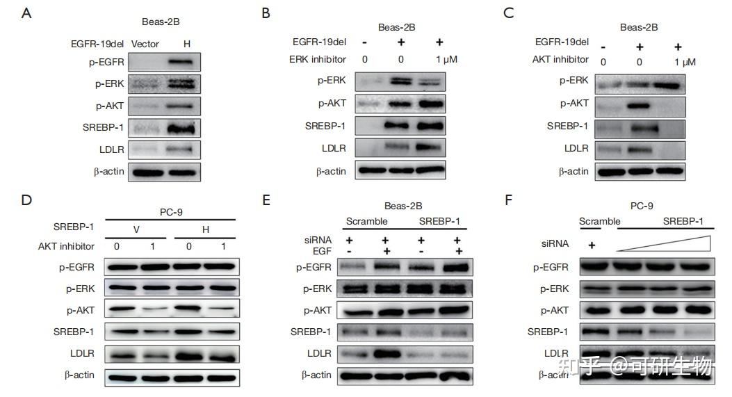 EGFR突变非小细胞肺癌的一种有前途的代谢疗法 - 知乎