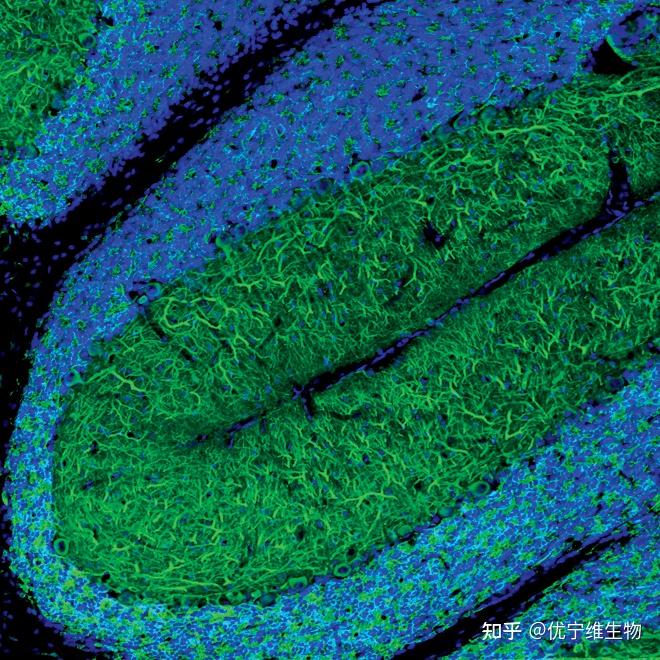 NeuN与MAP2：神经元生物标志物的深度解析 - 知乎