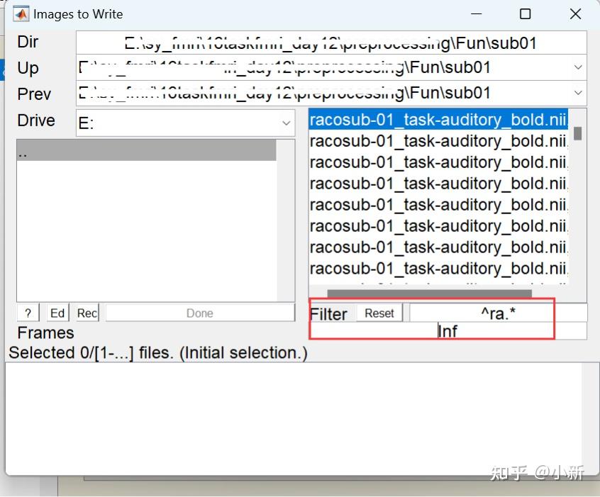 3-spm-fMRI任务态数据分析——预处理（下） - 知乎