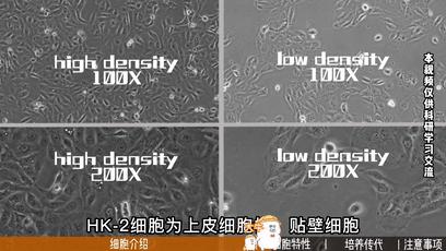 HK-2细胞培养，人肾皮质/近曲小管细胞培养攻略 - 知乎