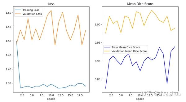 医学图像的深度学习的完整代码示例：使用Pytorch对MRI脑扫描的图像进行分割 - 知乎