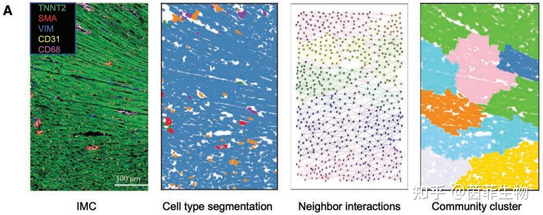 Circ Res | IMC绘制小鼠心肌缺血再灌注损伤的单细胞蛋白修饰时空图谱 - 知乎