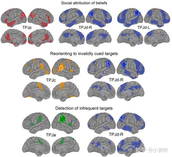 颞顶联合区（TPJ）与注意功能 - 知乎