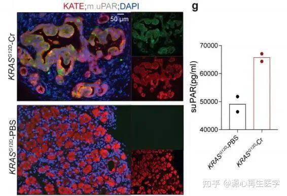 Nature丨“返老还童”新突破：uPAR助力CAR-T提高抗衰老效果 - 知乎
