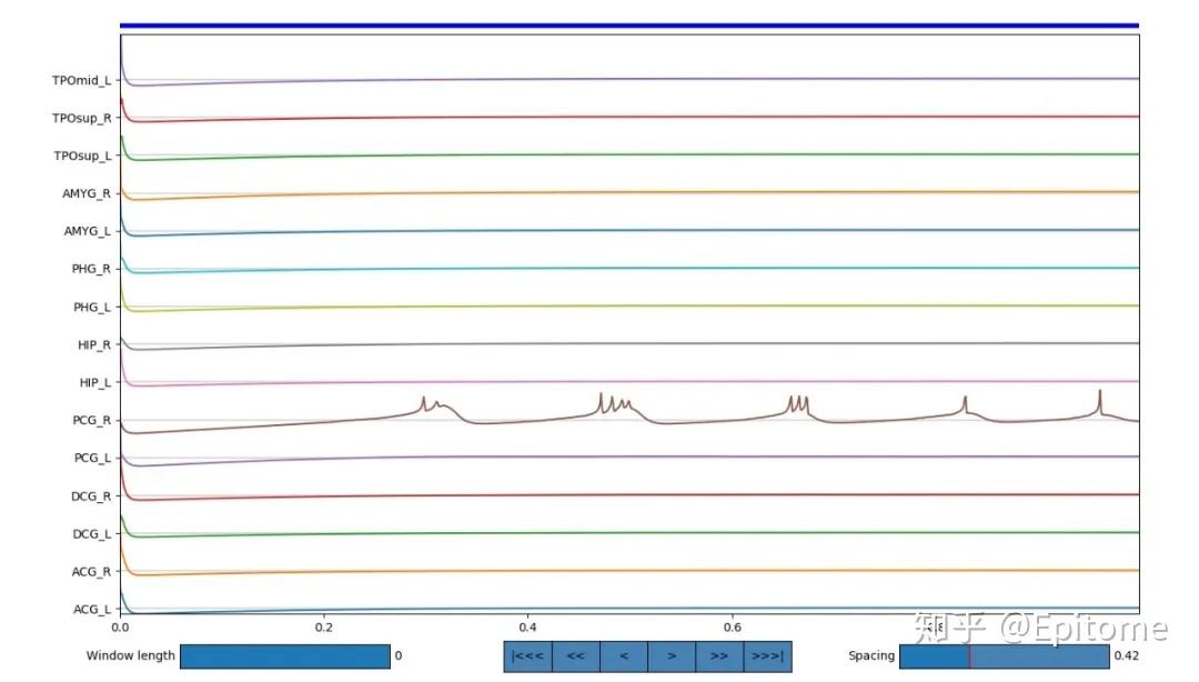 TheVirtualBrain: Brain Network Dynamics Simulator - 知乎
