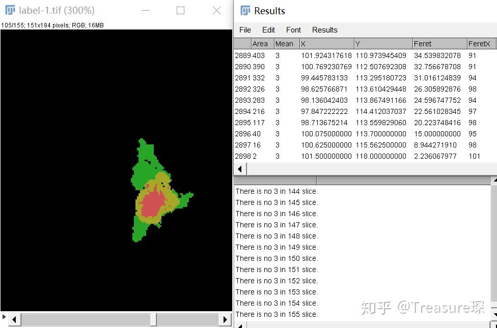 ImageJ开发教程——ROI操作 - 知乎