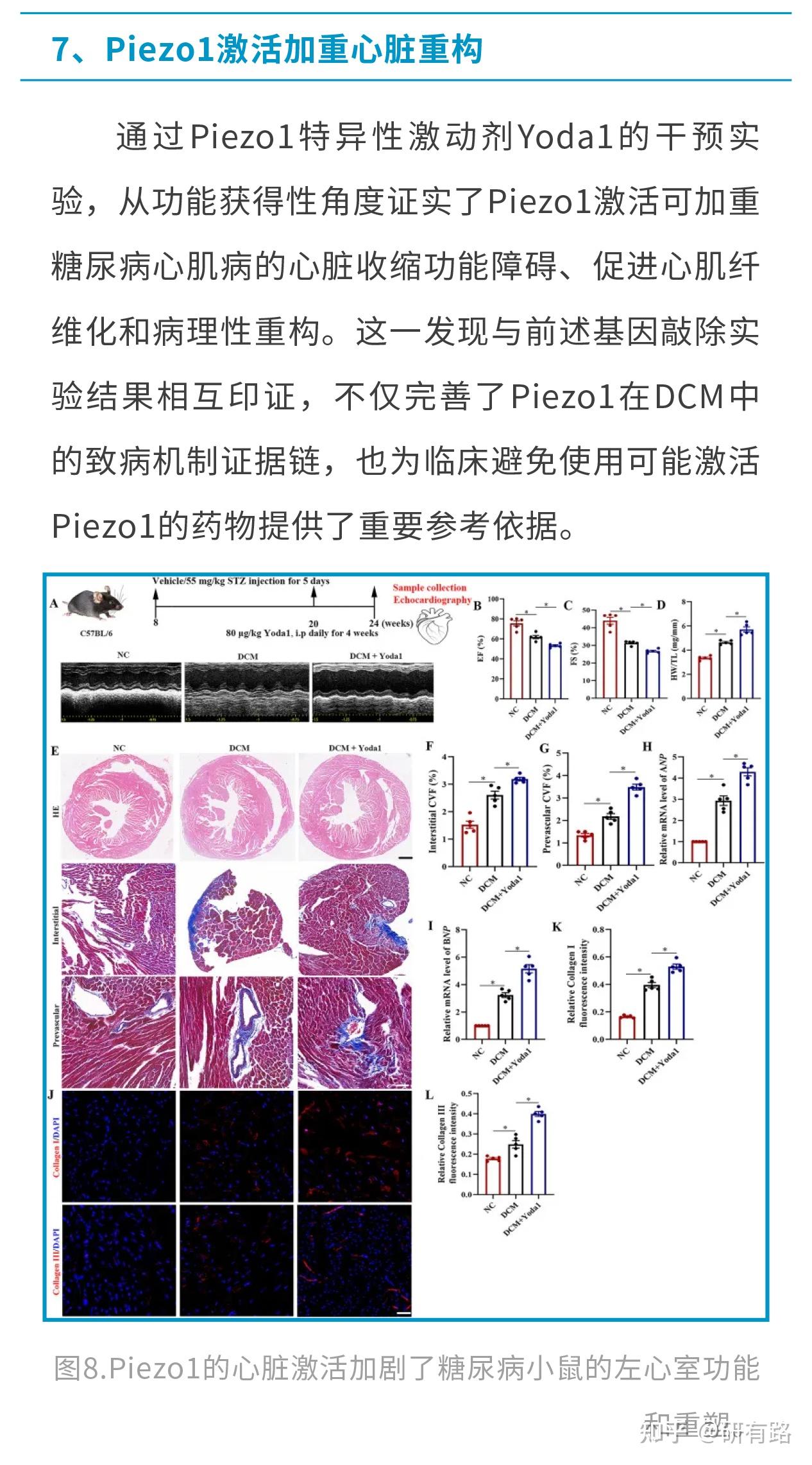 Piezo1喜登双科顶刊！"表型+分子+机制+干预"，山东中医药大学首揭Piezo1通过线粒体动态调控改善糖尿病心肌病~ - 知乎