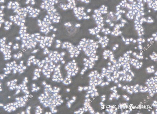 PBMC细胞提取怎么操作 ？看看这篇分享 - 知乎