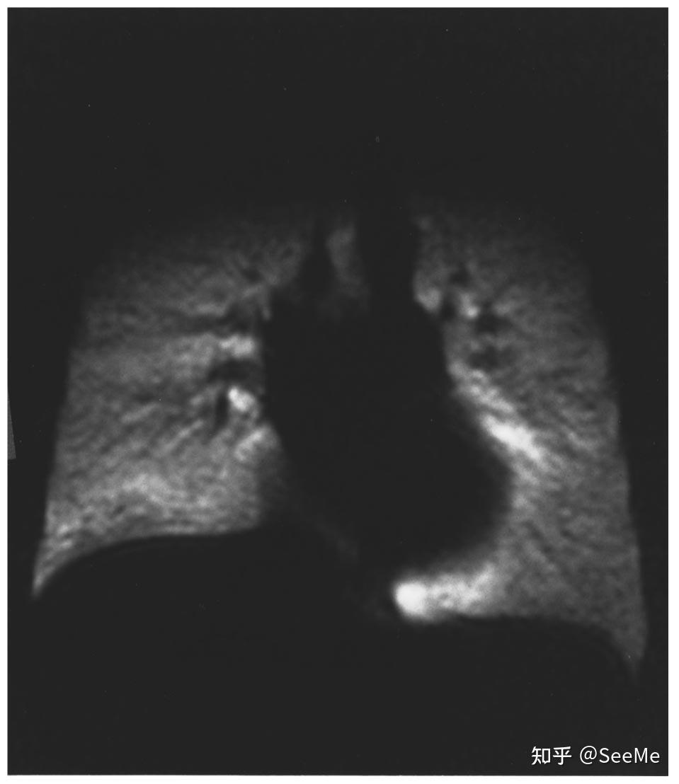 基础篇 | Spin-exchange Optical Pumping Chap1. 概述 - 知乎