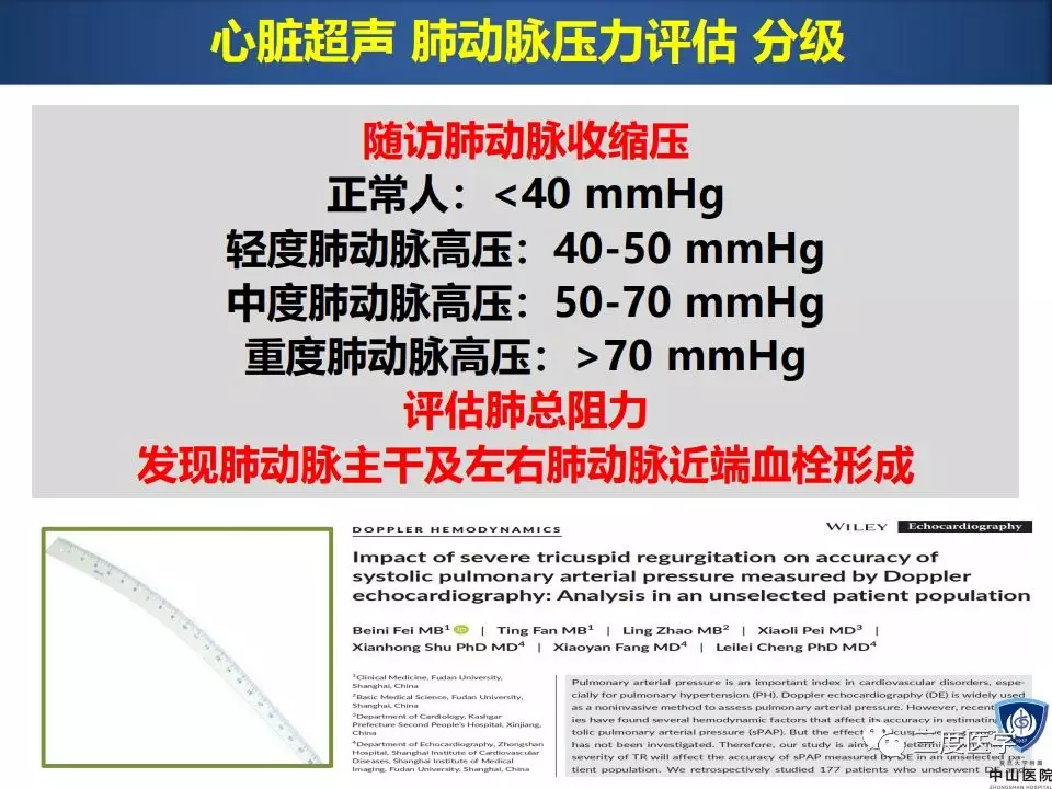 CCOC 2019课件分享 | 肿瘤心脏病学MDT门诊探索之路 - 知乎
