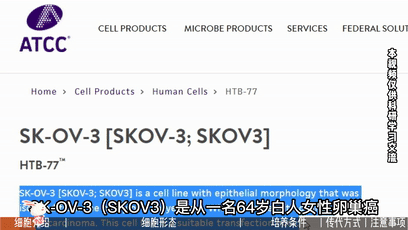 SK-OV-3细胞培养，人卵巢癌细胞培养攻略 - 知乎