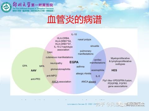 2022年嗜酸性肉芽肿性多血管炎(EGPA)诊治进展及美国风湿病学年会回顾，靶向治疗带来希望 - 知乎