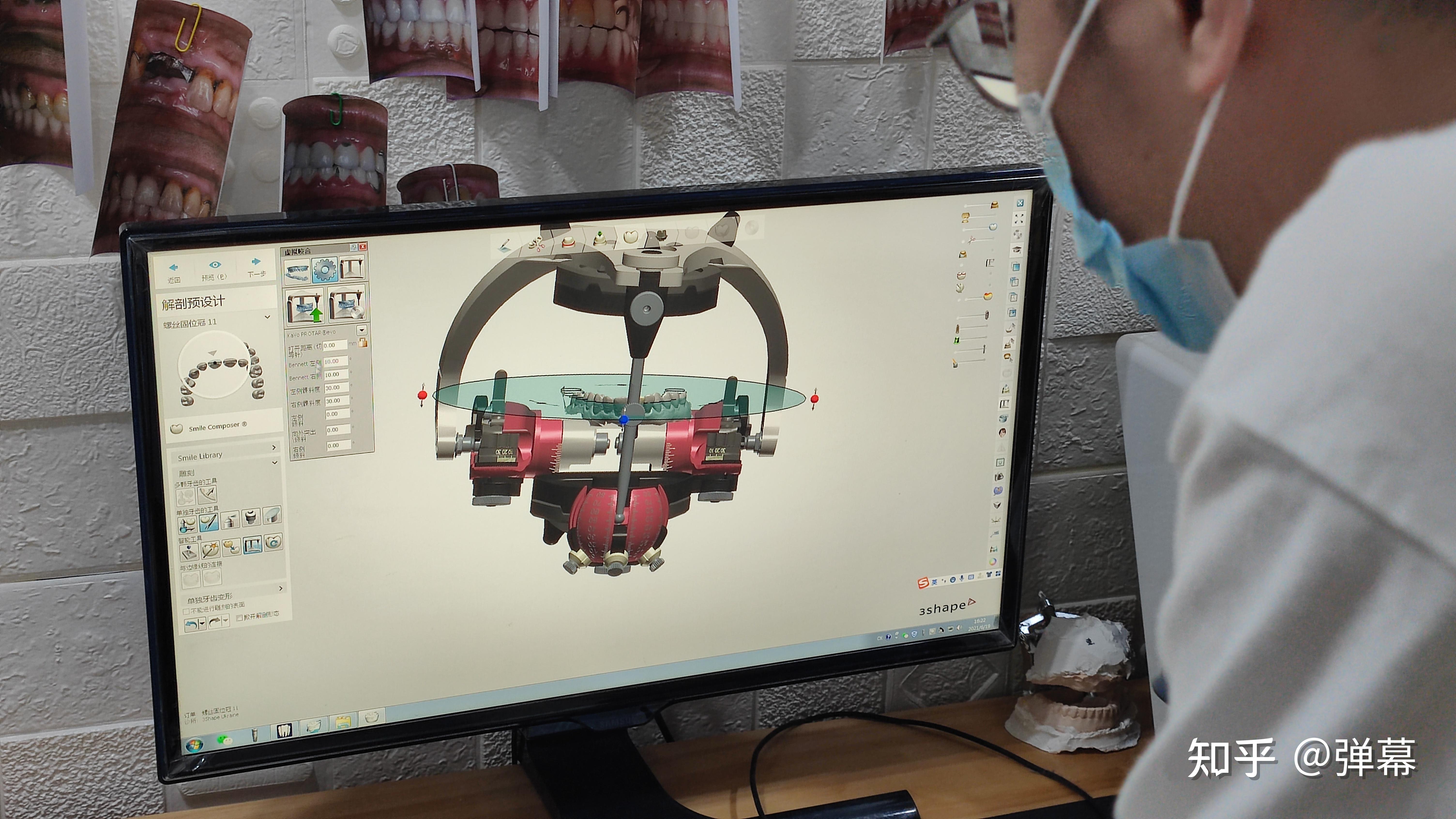 卡瓦 KaVo ARCUS digma 电子面弓齿科应用 - 知乎