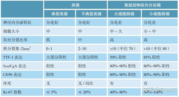 小细胞肺癌（SCLC） - 知乎