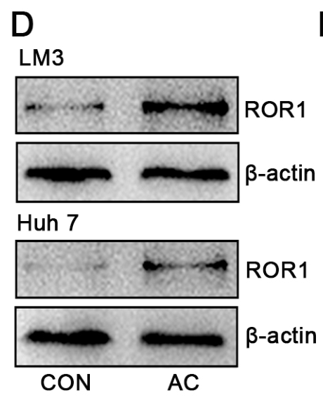 文献精读{酸+转移}：肿瘤干细胞成球实验 - 知乎