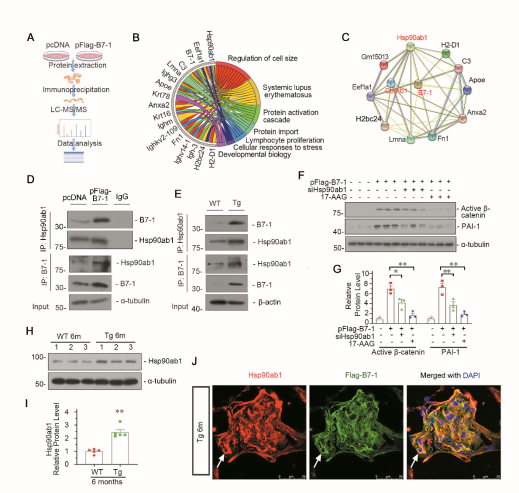 Cell Death Differ｜周丽丽团队发现足细胞损伤的重要机制 - 知乎