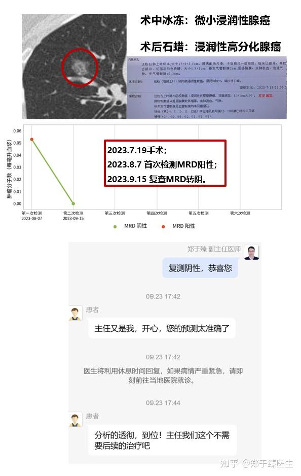 这三类早期肺癌，请慎重做MRD！ - 知乎